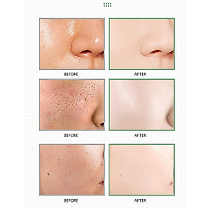 RUOQI 2PCS Green Tea Mask for Face, Blackhead Remover with Green Tea Extract, Deep Pore Cleansing, Moisturizing, Skin Brightening, Removes Blackheads for All Skin Types of Men and Women