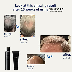 SIMFORT Carbonic Acid Shampoo 5.3oz & Conditioner 4.2oz Set for Men & Women, Fuller Thicker Stronger Hair Growth and Volumizing, Natural Ingredients, NO Paraben/Sodium/Sulfate (Set of 2)