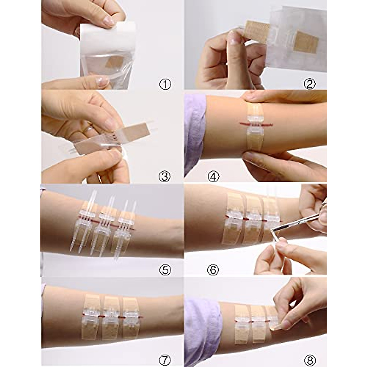 Israeli First Aid Emergency Laceration Closure Kit for Lacerations and Cuts, 10 Piece Set