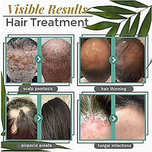 CPO Fᴏlliᴄle Nᴏᴜrishing HairGrᴏᴡth Serᴜm, Hair Growth Oil, Hair Serum for Thicker, The Hair Revival Serum, Hair Loss & Hair Thinning Serum, Hair Growth Serum for Men Women, 30ml