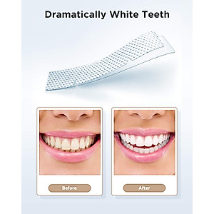 Gloridea Teeth Whitening Strips, Pack of 28 Strips (14 Treatments), Mint flavor Package may vary