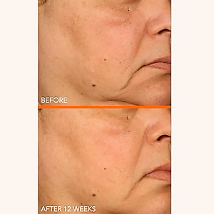 Dr Dennis Gross Vitamin C Lactic 15% Firm & Brighten Serum: Visibly Improve Signs of Aging, 1 oz