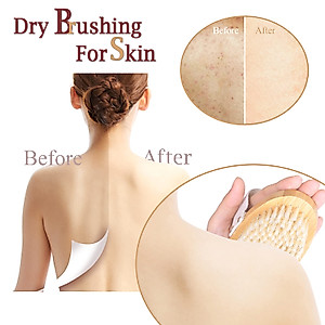 Ftzotof Dry Brush, Dry Brushing Body Brush with Natural Bristles, Exfoliating Brush Body Scrub for Dry Skin, Cellulite Treatment, Lymphatic Drainage and Blood Circulation Improvement, Medium Strength