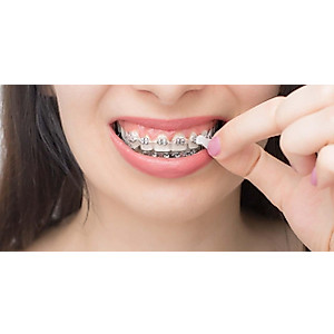Genuine Orthowax - Orthodontic Wax for Braces Wearer - Stick Better Than competitors