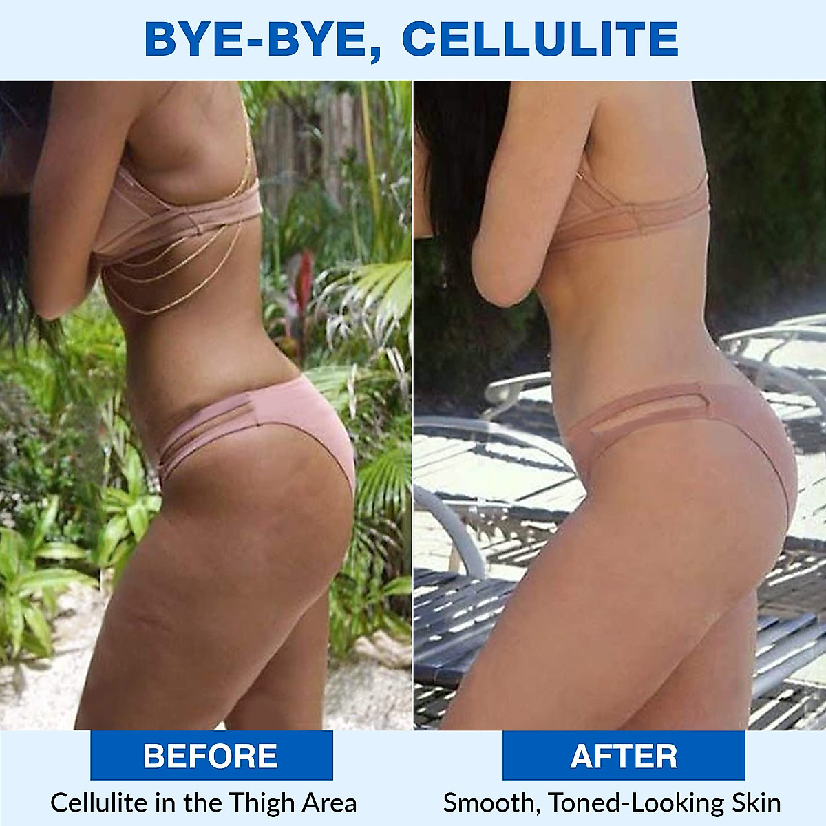 LURE Essentials Sculpt Silicone Cupping Theapy Set Anti Cellulite Cup Massager, Vacuum Suction for Lymphatic Drainage