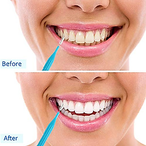 50 Pieces Braces Brush for Cleaner Interdental Brush Toothpick Dental Flossing Head Oral Hygiene Flosser Tooth Cleaning Tool (Light Blue, Purple, Yellow, Gray, Light Green)