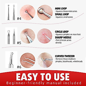 Cbiumpro Blackhead Remover Tools, Pimple Popper Tool Kit, Blackhead Extractor Tool, Zit Popper Tool, Professional Pimple Extractor Tool for Blackhead, Acne, Whitehead, Comedone on Nose - with Case