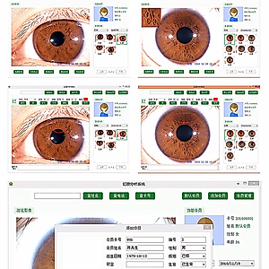 QXIUDDYS Iridology Camera Analyzer, Iris Analysis Camera, 5.0 MP USB Iris Analyzer Iridology Camera, Eye Iridology Camera, HD 30x Iris Lens and Driver-Free Analysis Software