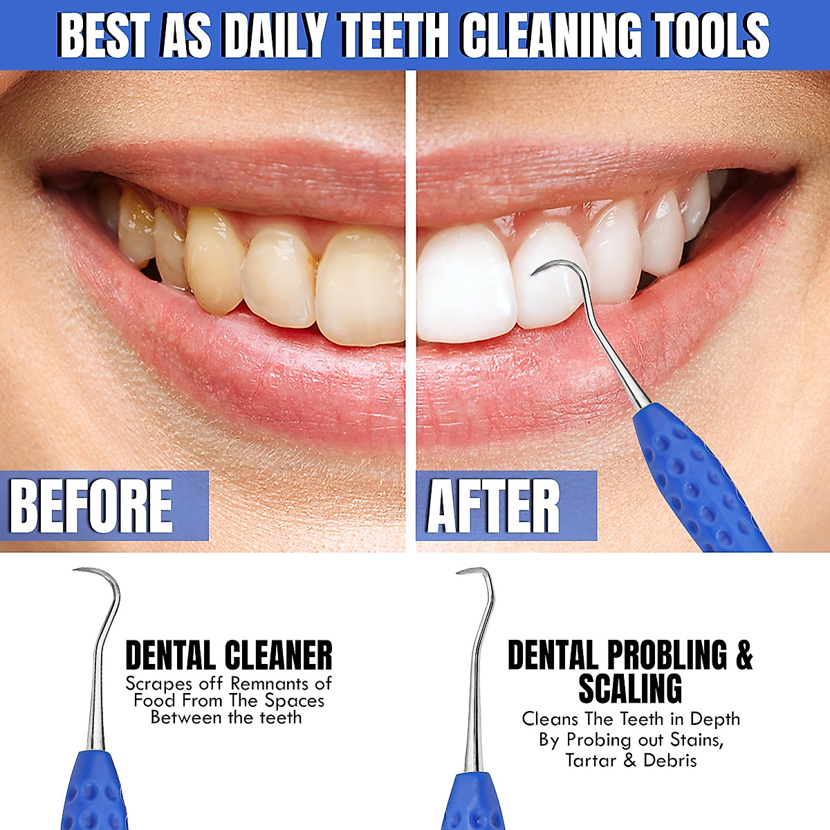 Professional Dental Tools Tartar Scraper For Dentist, Personal and Pets Use Plaque Remover With Comfortable Grip, Double ended Silicon Grip Scaler