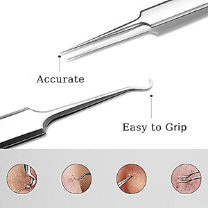 Professional Facial Blackhead Remover Tweezers,3Pcs Precision Pimple Popper Tool Kit for Whitehead Ance Blemishs Comedones Stainless Steel Makeup Tool - Matte