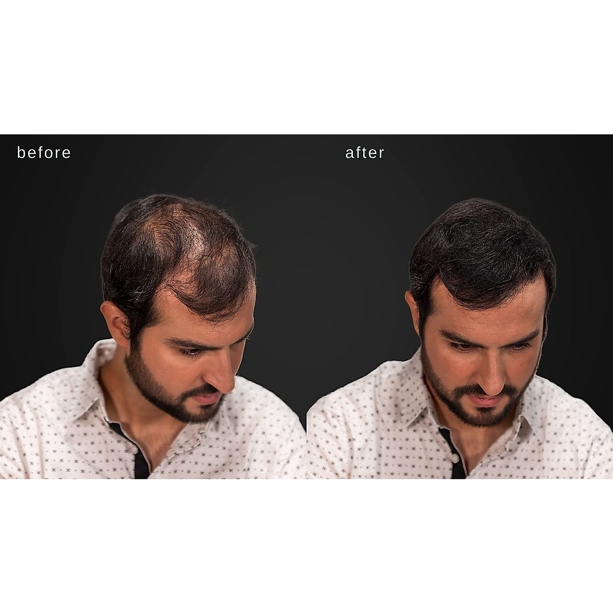 LUXE Hair Thickening Fibers - CONFIDENCE IN A JAR – 2 Months+ Supply! – Hypoallergenic, Dermatologist Tested – Multiple Colors Available (Dark Brown)