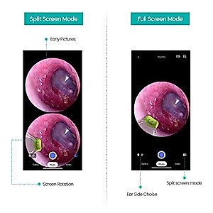 Wireless Otoscope Ear Camera with Dual View, 3.9mm 720PHD WiFi Ear Scope with 6 LED Lights for Kids and Adults, Compatible with Android and iPhone