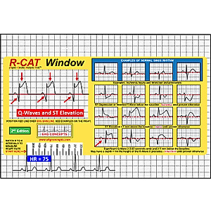 R-CAT EKG Window 2nd Edition