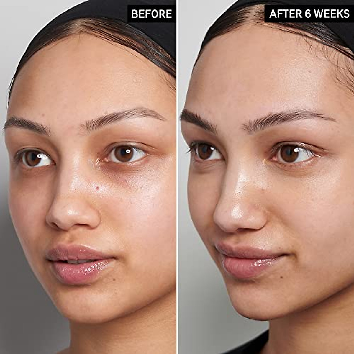 The INKEY List 15% Vitamin C + EGF Serum, Illuminate and Regenerate Dull Skin, Improve Skin Elasticity, 1.0 fl oz