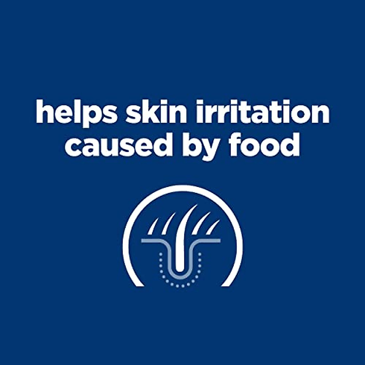 Hill's Prescription Diet z/d Skin/Food Sensitivities Dry Cat Food, Veterinary Diet, 4 lb. Bag