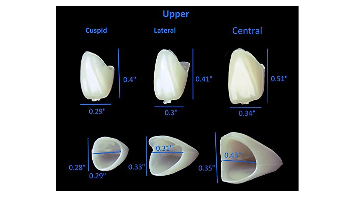 100 PCS Mixed Dental Temporary Crown Kit - Fast Placement