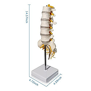 Evotech Lumbar Spine Anatomy Model with Sacrum and Spinal Nerves, Didactic Replica of Lumbrosacral Section with Nerves and A Herniated Disc at L4, Includes Base for Medical Teaching Display