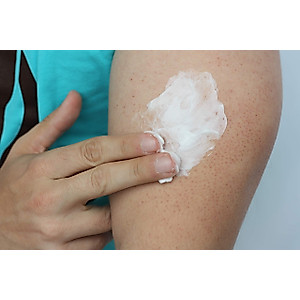 KP Elements Keratosis Pilaris Lotion (4 fl oz) - Natural Keratosis Pilaris Treatment, Moisturizing & Exfoliating AHA Lotion for KP, Vegan, Made in USA