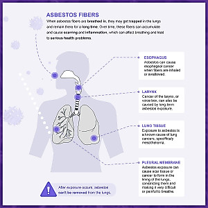 BALORP DIY Test Asbestos 2 PK- Includes All Lab Fees - Test Popcorn Ceiling, Tile, Insulation, Adhesive, Mastic, Drywall and Other Materials for Asbestos, DIY408