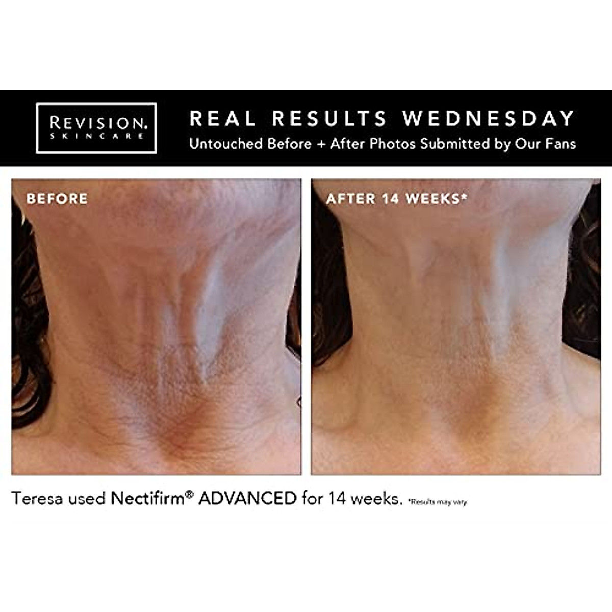 Revision Skincare Nectifirm Advanced Neck Firming Cream, 1.7 oz