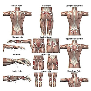 TensCare - 1in Cicrular Reusable Electrodes. Perfect for use with TENS, EMS, Micro Current and IFT. Great for Small Locations Such as Hands and Face. 1 Pack of 10 Electrodes