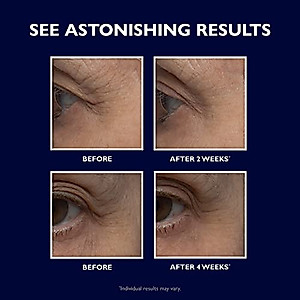 Retinol Fusion PM Eye Cream | Retinol Eye Cream for Dark Circles and Puffiness, Anti-Aging Eye Cream