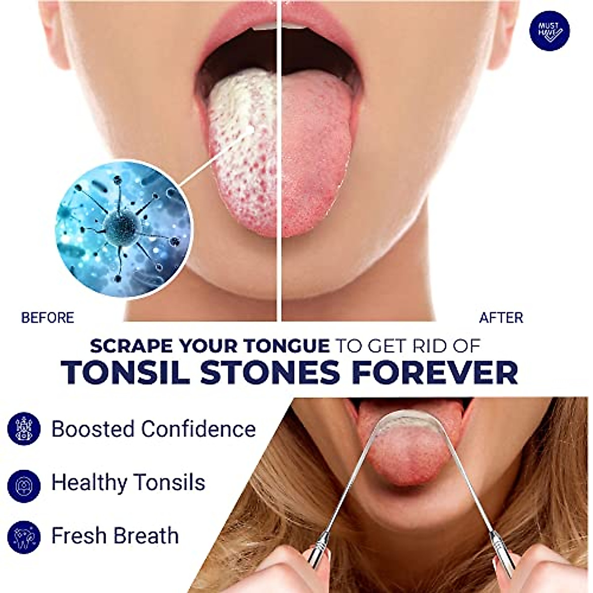 ORAVIX Tonsil Stone Removal Kit - Tonsil Stone Remover - Fast Painless Tonsillolith Remover Tool - Tonsil Cleaner - Fight Bad Breath - Tonsil Stone Removal - Oral Irrigator - Tongue Scraper - 7 Pieces