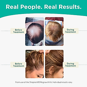Inner Wellness Trio - Dietary Supplements for Full, Strong, Healthy Hair - Collagen Powder, Daily Vitamin, and Prebiotic Formula | Recommended by Dermatologist | Shapiro MD