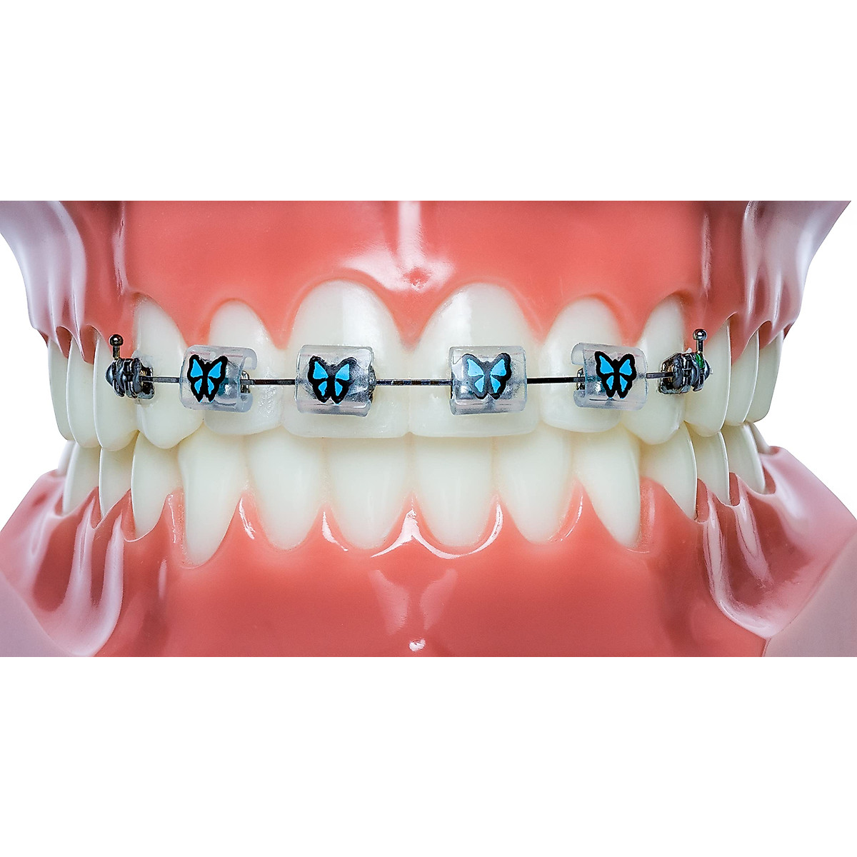 Snapcaps Braces Bumper Cover, Orthodontic Bracket Wax Substitute, Alternative Snap-on Braces Guard Braces Accessories 10 pack (Butterfly)