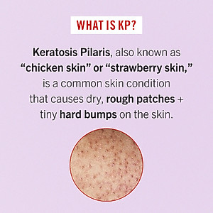 First Aid Beauty - Bye Bye Bumps Kit: KP Bump Eraser Body Scrub, 4 oz, Smoothing Lotion, 1oz, and Ingrown Hair Pads, 28 Pads, Deep Moisture Exfoliating Skin Treatment Set with BHA & AHA, 3ct