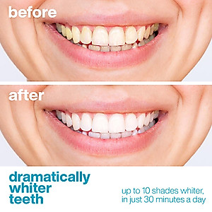 AquaSonic Professional Teeth Whitening Strips - Enamel Safe Teeth Whitening with Hydrogen Peroxide - Easy to Use, Non-Slip, Affordable & Effective (Unflavored)