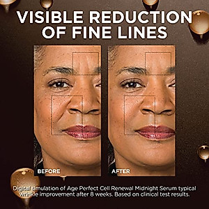 L'Oreal Paris Age Perfect Cell Renewal Midnight Anti-Aging Face Serum with Patented Antioxidant, Smooth Wrinkles, Firm, Revitalize + Eye Cream Sample