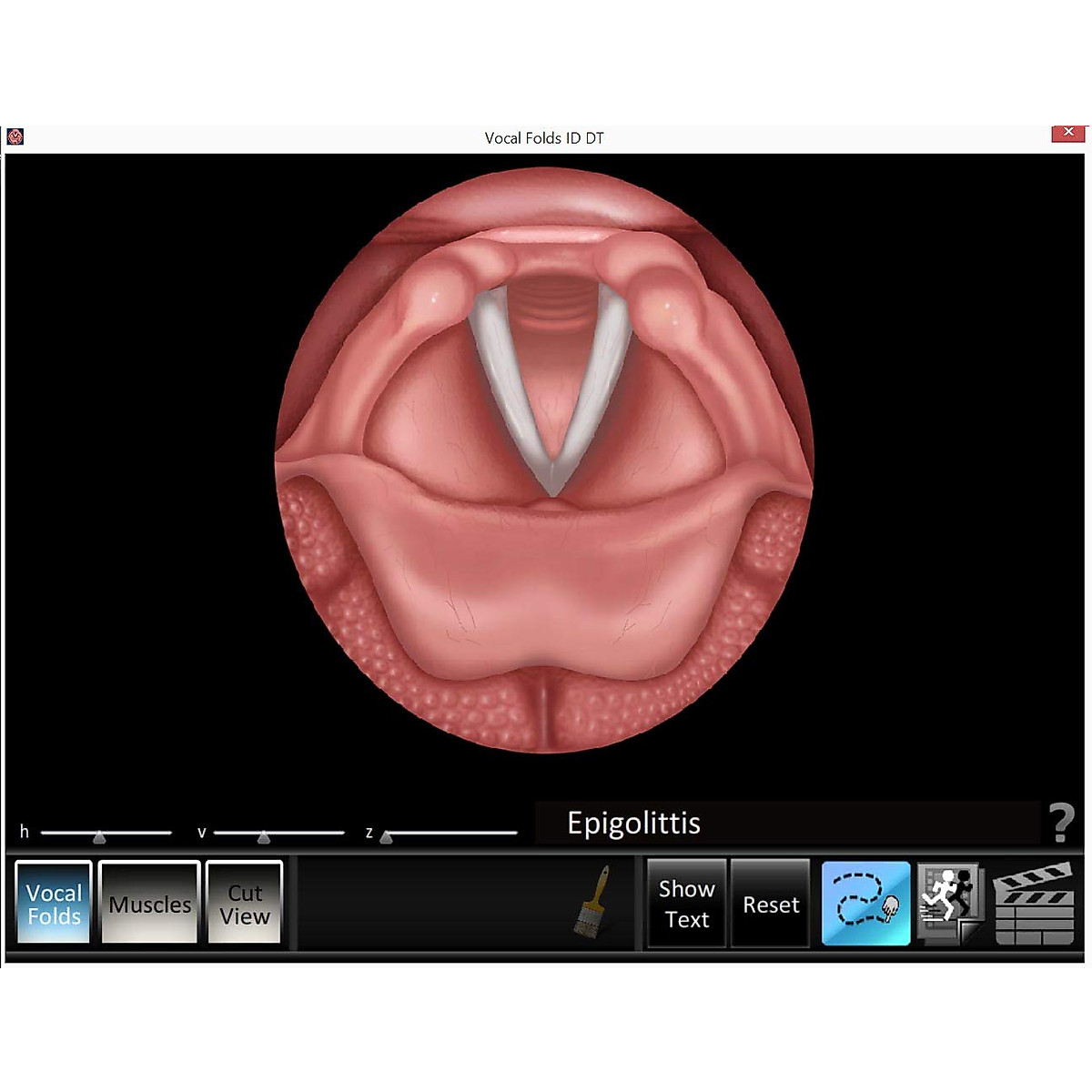 Vocal Parts, Pharynx & Larynx Anatomical Chart with Software Larynx and Vocal Fold ID Speech Language Pathology, SLP, Singing