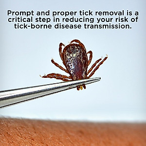 BUG BITE THING Tick Remover Tool for People & Pets, Patented Two Sided Stainless Steel Design with Fine Tipped Tweezers, Formerly Known as TickEase