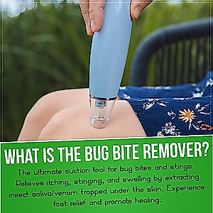 Bug Bite Remover Get Itch Relief from Mosquito Bites with This Suction Tool. This is Similar to The Bug bite Thing seen on Shark Tank, Except Ours is Better with a Battery Powered Suction Pump.