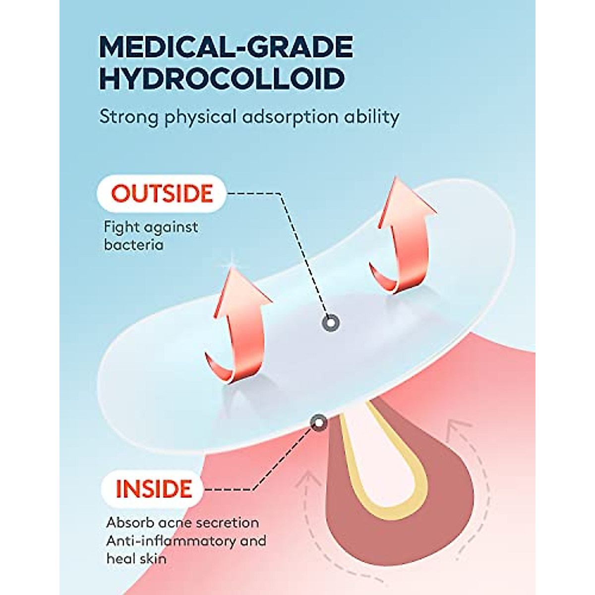 ZATKTK Acne Pimple Patch (180 Counts 4 Sizes), Invisible Hydrocolloid Acne Patch with Tea Tree Oil & Calendula Oil, Acne Spot Healing Patch Zit Patches for Face