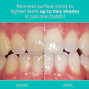 Opalescence Teeth Whitening Toothpaste (Pack of 2) - Cool Mint Original Formula - Oral Care, Gluten-Free - 4.7 Ounce Made by Ultradent.- TP-5166-2