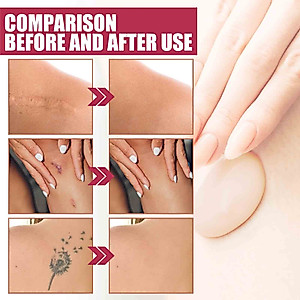 BodyBlendz Body Makeup Waterproof Foundation, Leg And Body Makeup Waterproof Foundation Covers Up Scar Blemishes Spots, Foundation With High Coverage, Long-Lasting, Evens Skin Tone (1PC)