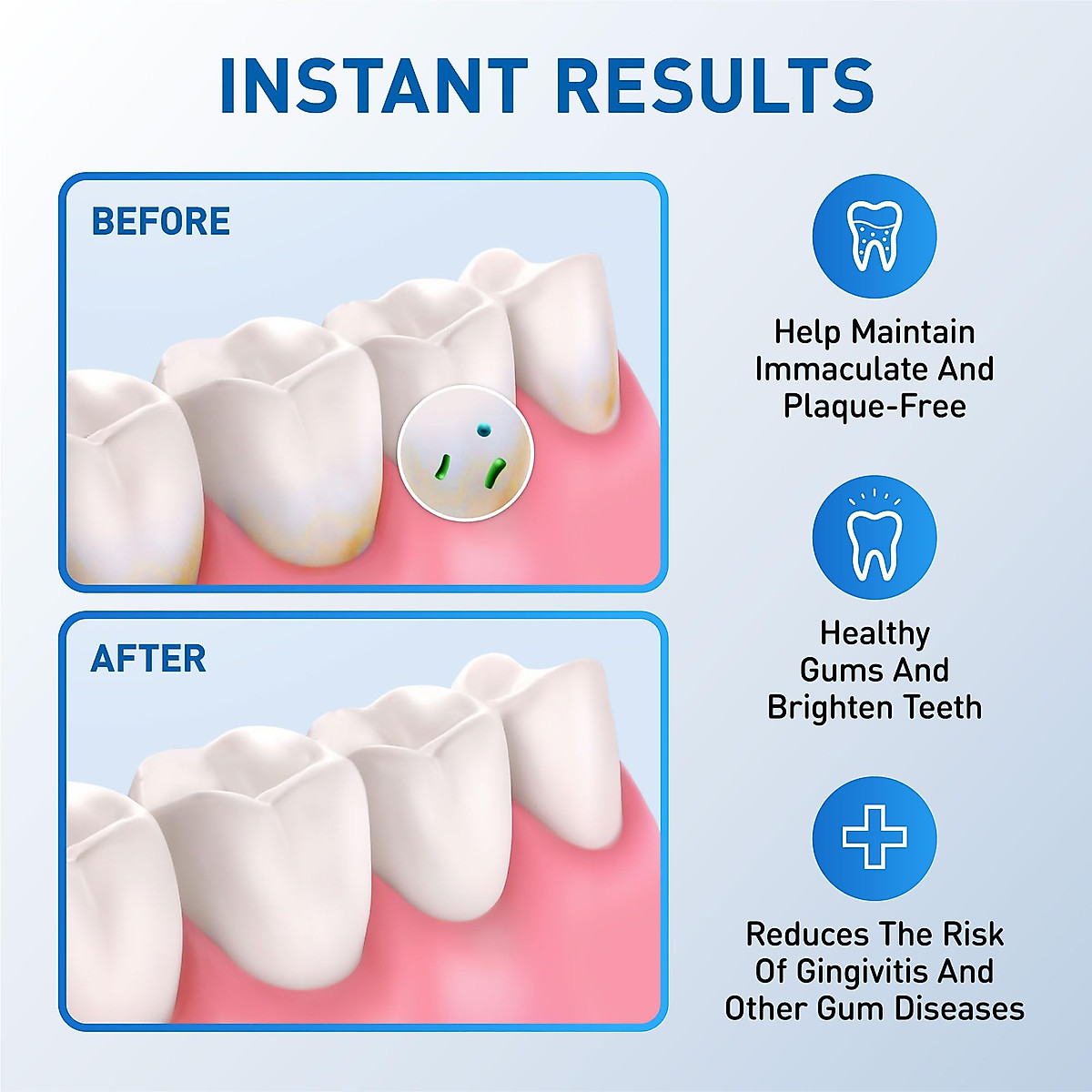 Replacement Heads for Waterpik, Water Flosser Replacement Tips for Waterpik (6 Classic Jet Tips with Case)