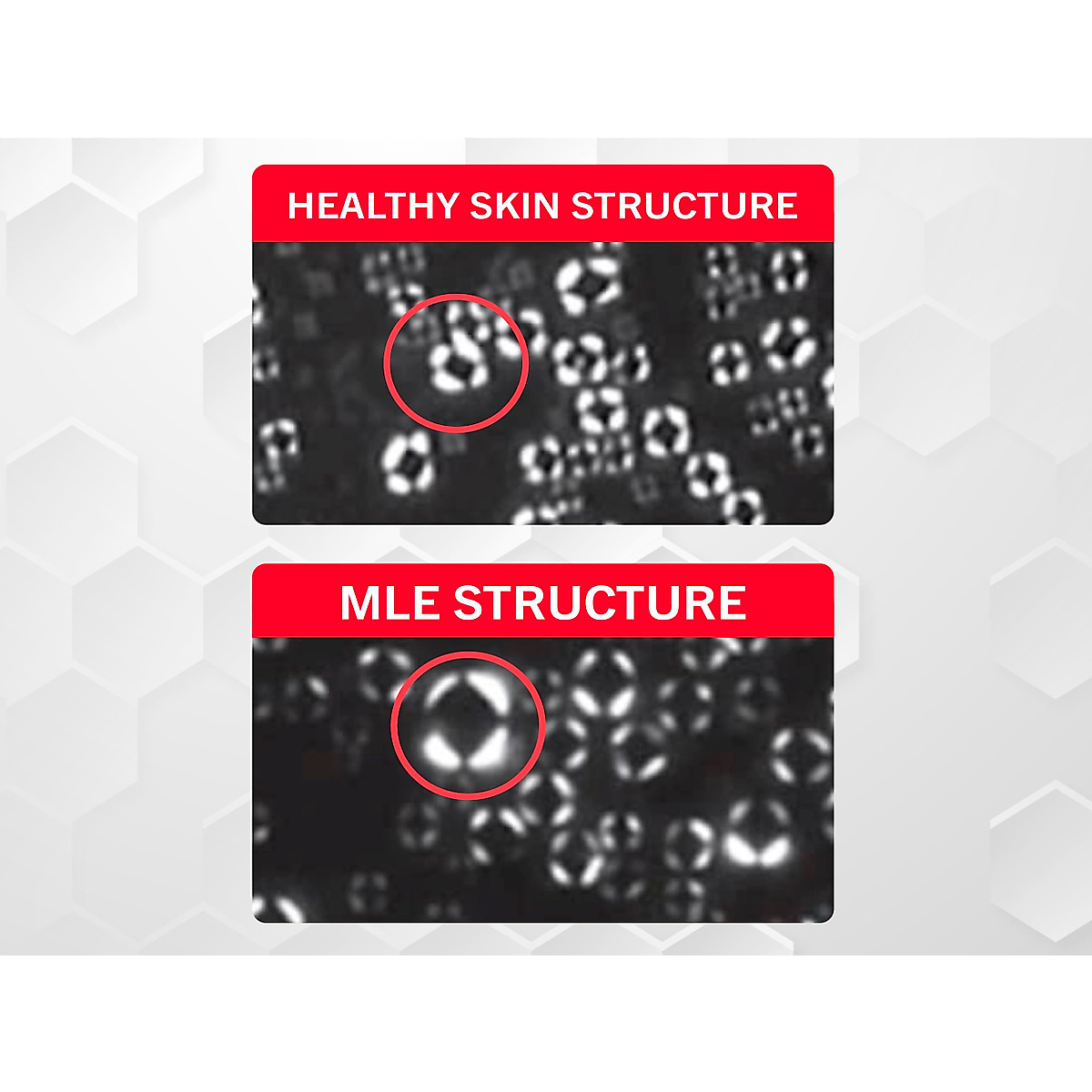 ATOPALM Intensive Moisturizing Cream for Dry & Sensitive Skin, Face Moisturizer, Replenishes Hydration, Paraben-Free, K-Beauty, skin barrier ceramide cream, 3.4 Fl Oz, 100ml (3.4 Fl Oz)