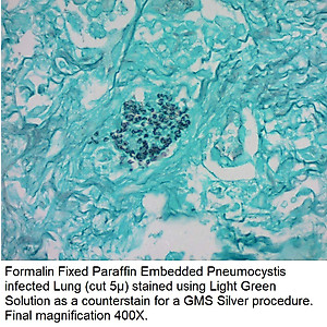 Light Green Solution, 1 Gallon