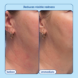 Skinfix Barrier+ Triple Lipid-Peptide Cream: Enriched with Lipids, Peptides, Hyaluronic Acid, and Shea Butter for Brightening, Firming, and Plumping, 3 oz