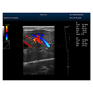 CONTEC CMS1700A-VET/Veterinary Color Doppler ultrasonic Systems (Rectal Linear, Convex Probe)