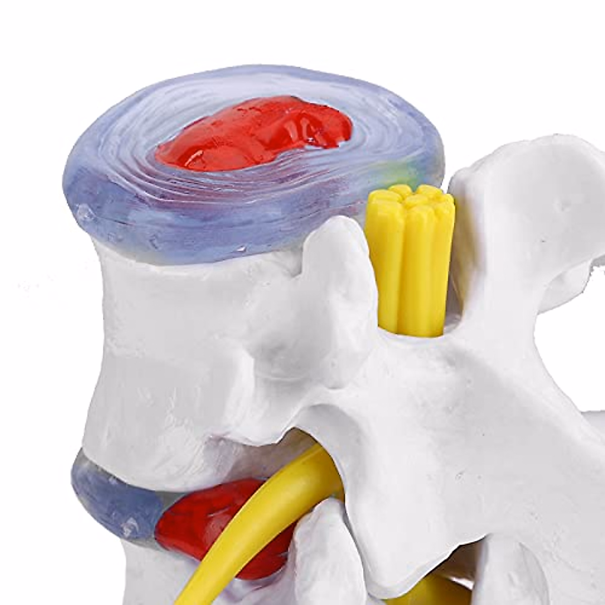 YUYTE Human Spine Model, Human Anatomical Lumbar Disc Herniation Model Human Spine School Training Supplies Excellent Way for Demonstrating Disc, Restore The Details of The Human Spine