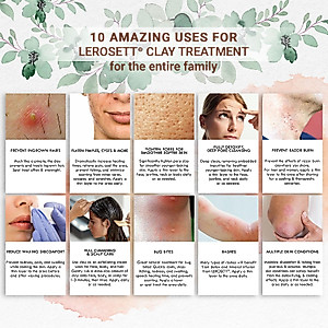 LEROSETT Facial Clay for Acne, Spot Treatment & Clay Mask, For Oily & Congested Skin, Reduces Blemishes, Blackheads & Pimples, Removes Ingrown Hairs, Tighten Pores, Vegan, 650+ Uses