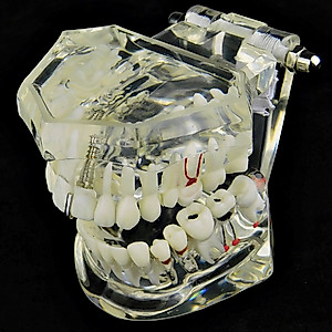 Gap Grillz Silver Tone Single Plain Tooth Top or Bottom Teeth Single Hip Hop Grills