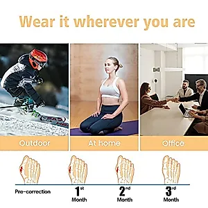 FSHERO Bunion Corrector for Women,Toe Straightener Pain Relief Socks,Bunion Splint,Non-Surgical Hallux Valgus Corrector for Day and Night(Large,Skin)