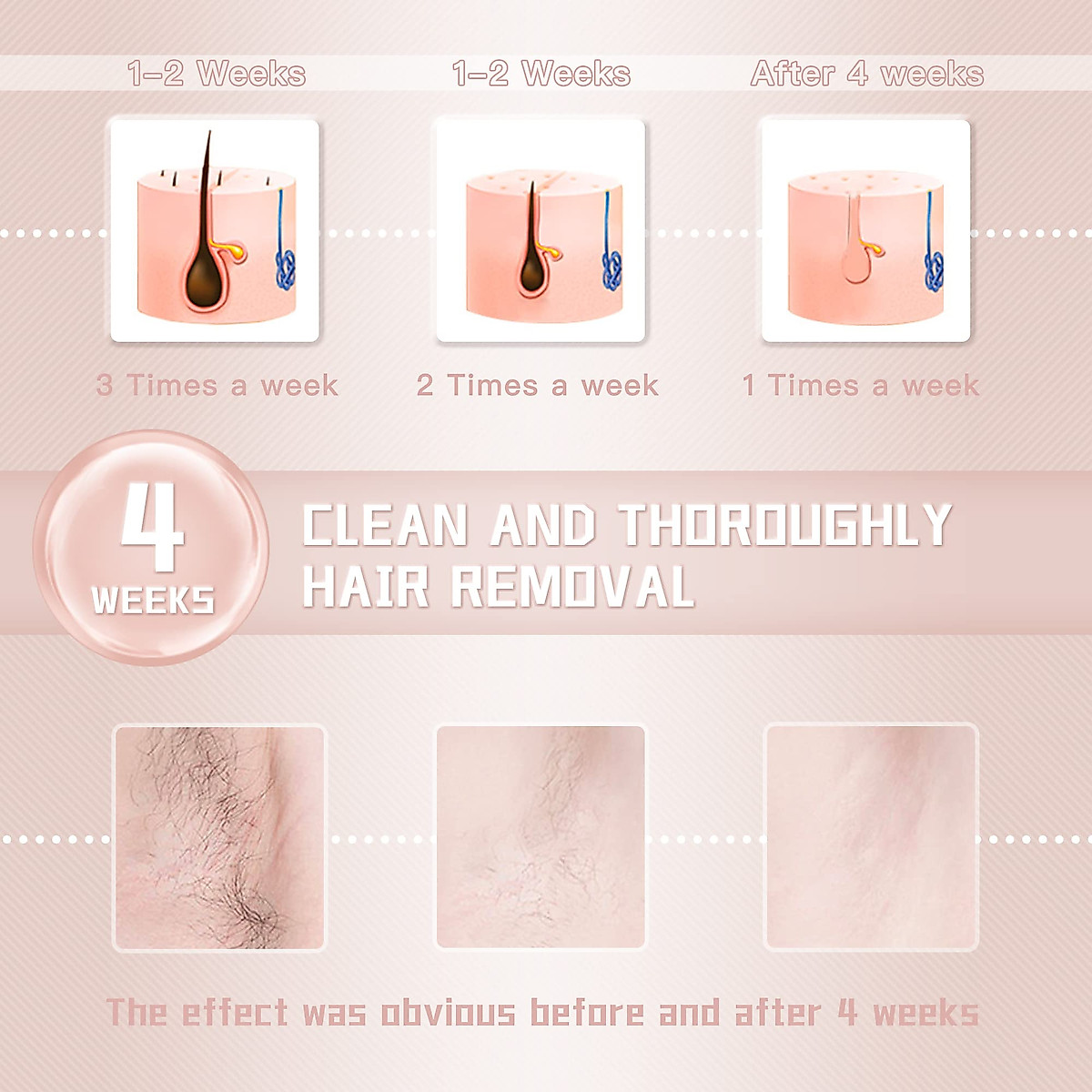 Laser Hair Removal for Women and Men At Home Permanent Hair Removal 999,999 Flashes Painless Hair Remover on Armpits Back Legs Arms Face