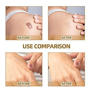 Tattoo Cover Up,Scar Cover Stickers Tape,Waterproof Ultra Thin Patch Pads Concealer Body Leg Bruise Stretch Scar Dark Spots Vitiligo Skin Makeup,Long Lasting Invisible Tattoo Flaw Conceal Patch 60PCS