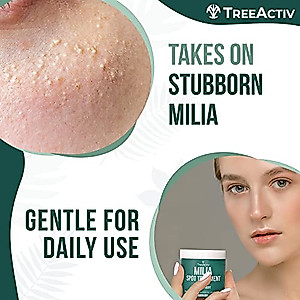 Treeactiv Overnight Milia Spot Treatment 0.5oz, Improves Milia Overnight, Effectively Treat Milia Blemishes in 2 Weeks, Natural Milia Treatment, 120+ Uses